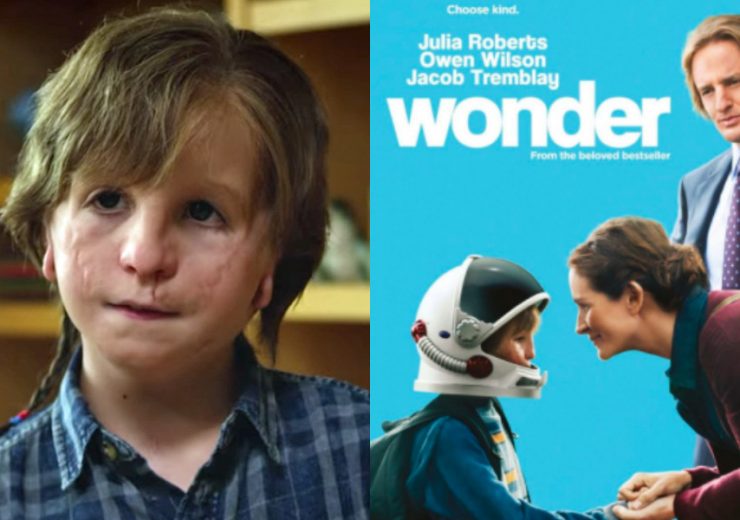 Auggie Pullman Archives | Tú en línea